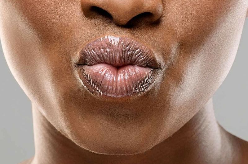 Solución para Labios Secos | Clínica Vladimir Rovira