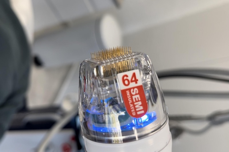 Secret Duo para Rejuvenecimiento Facial | Clínica Vladimir Rovira